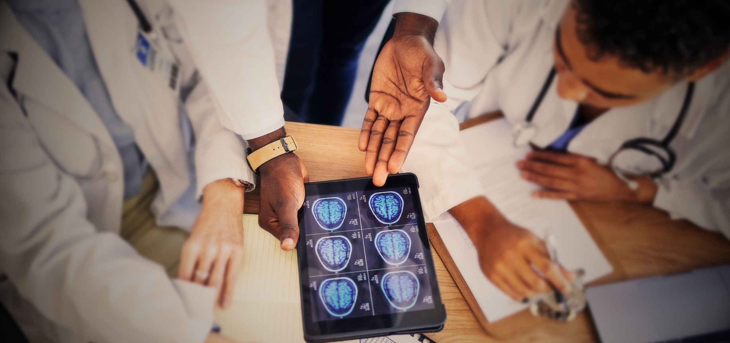 Enhancing Accuracy In Normative Modeling Insights From Brain